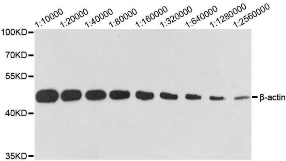 Recombinant Rabbit Monoclonal Antibodies - Creative Diagnostics