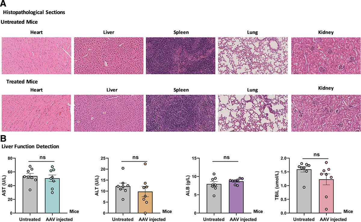 Adeno-Associated Virus (AAV) Family - Creative Diagnostics