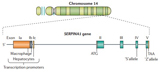 Alpha 1 Antitrypsin Deficiency - Creative Diagnostics