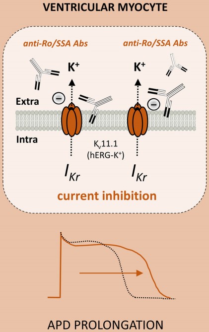 Anti-SSA/Ro Introduction - Creative Diagnostics