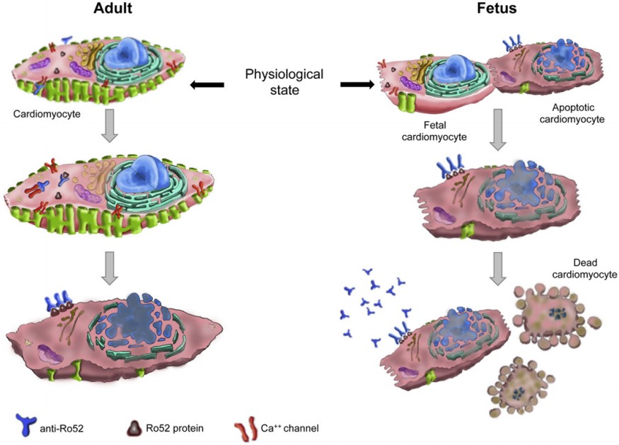 Anti-SSA/Ro Introduction - Creative Diagnostics