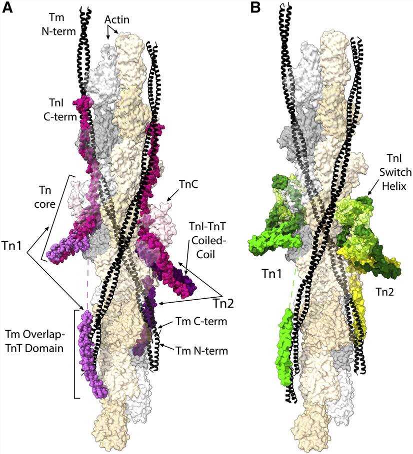 Troponin Introduction - Creative Diagnostics