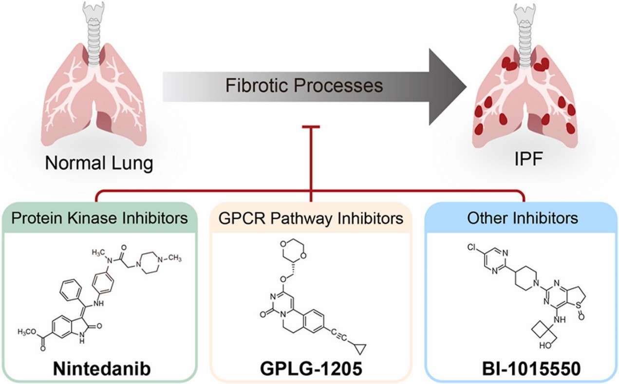 Anti-fibrotic Small Molecule Drugs in Idiopathic Pulmonary Fibrosis ...