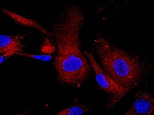 Antibodies for Flow Cytometry (FC) - Creative Diagnostics