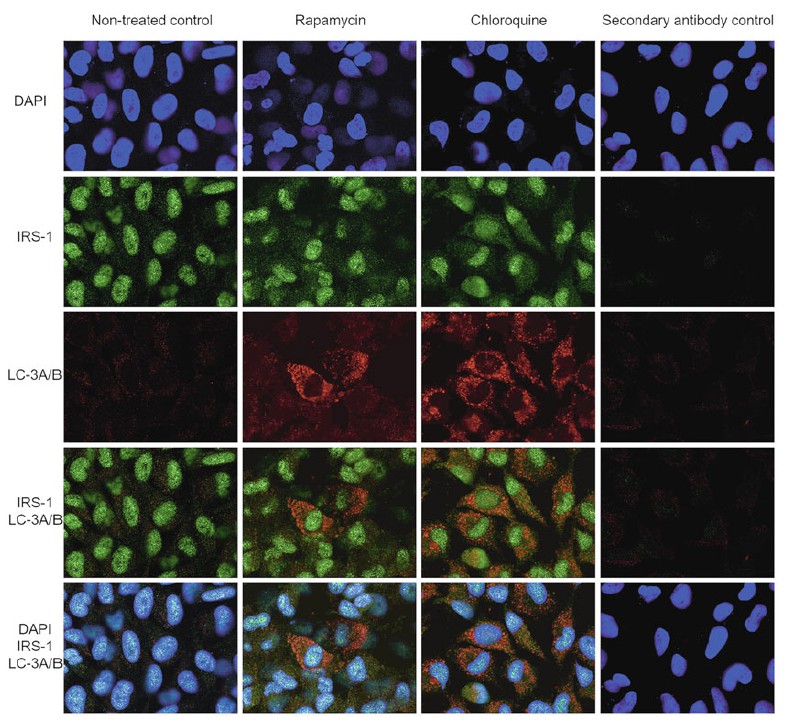 Antibodies for Immunocytochemistry (ICC) - Creative Diagnostics