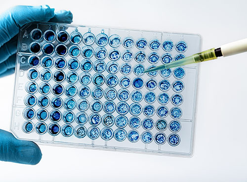 Antibodies for Immunoassays and ELISA - Creative Diagnostics