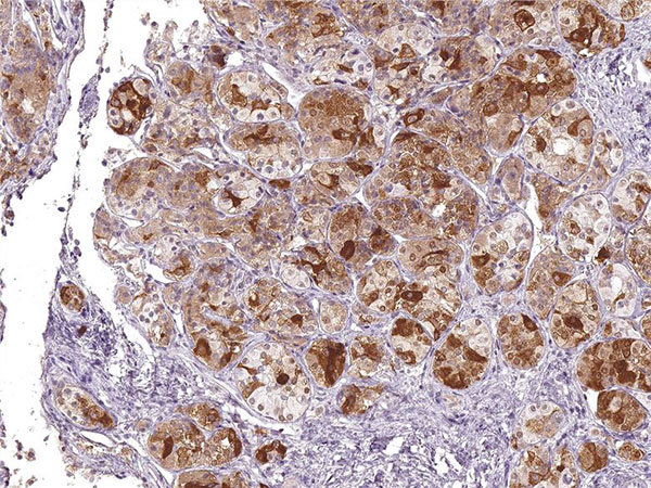 Creative Diagnostics can offer monoclonal or polyclonal antibodies for IHC with different ...