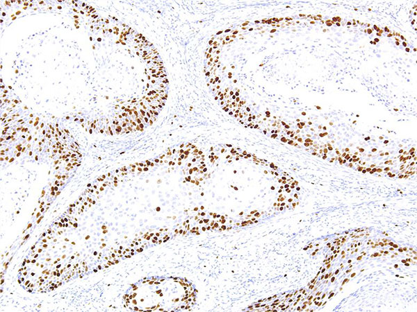 Creative Diagnostics can offer monoclonal or polyclonal antibodies for IHC with different ...