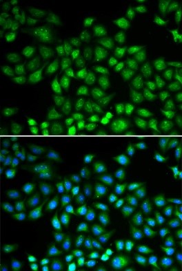 Antibodies for Immunofluorescence (IF) - Creative Diagnostics