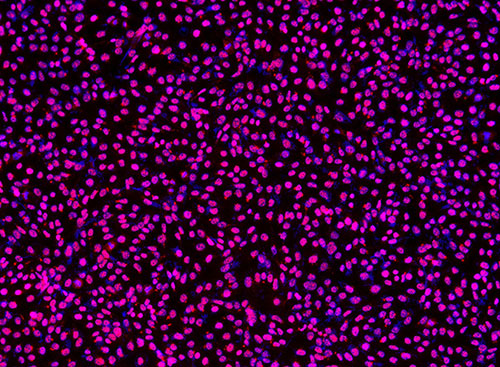Antibodies for Immunofluorescence (IF) - Creative Diagnostics