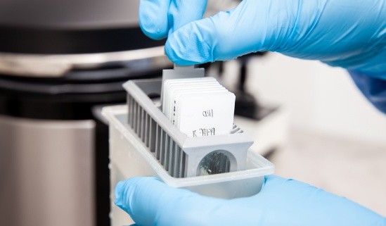 Antigen Generation - Creative Diagnostics