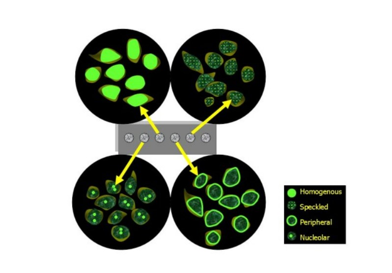 Antinuclear Antibodies - Creative Diagnostics