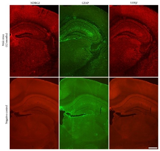 Astrocyte Markers - Creative Diagnostics
