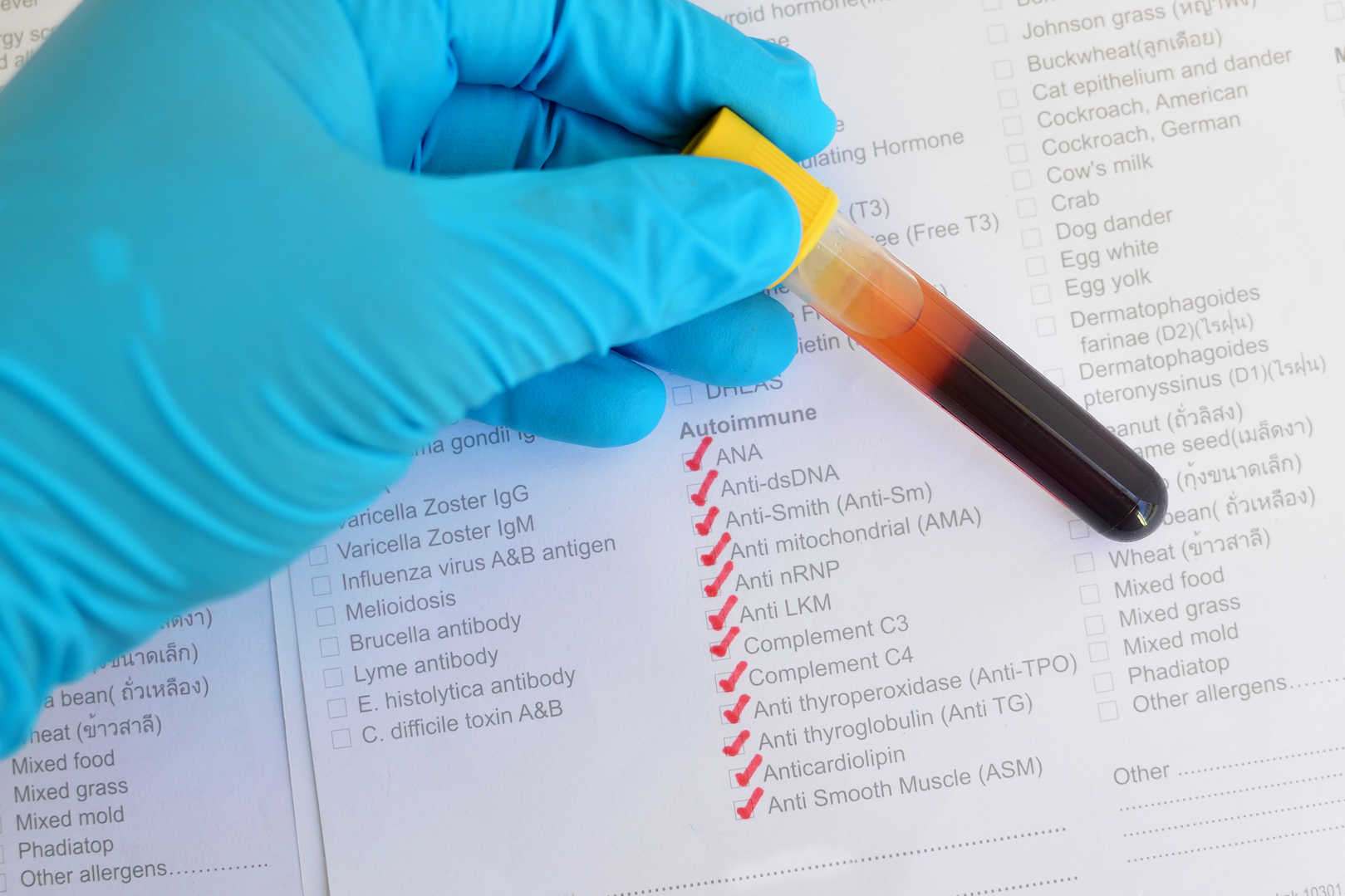 Autoimmune Disease Analysis Services - Creative Diagnostics