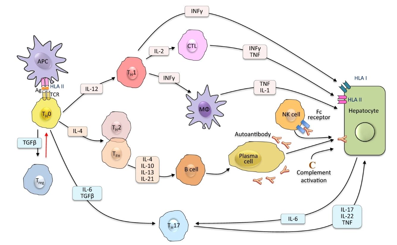 Autoimmune Hepatitis (AIH) - Creative Diagnostics