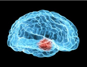 Beta Synuclein Pre-Formed Fibrils (PFFs) - Creative Diagnostics