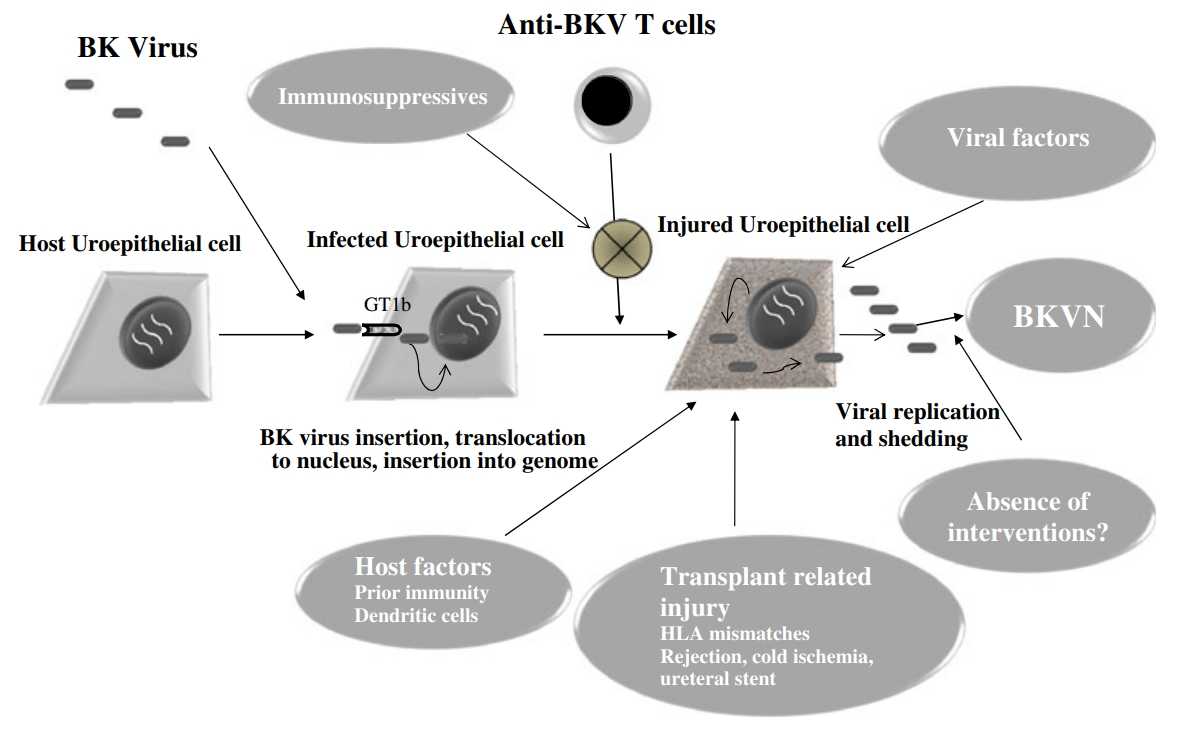 BK Virus (BKV) Symptoms - Creative Diagnostics