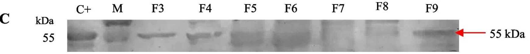 Anti-HPV52 L1 polyclonal antibody (CABT-B8799) - Creative Diagnostics