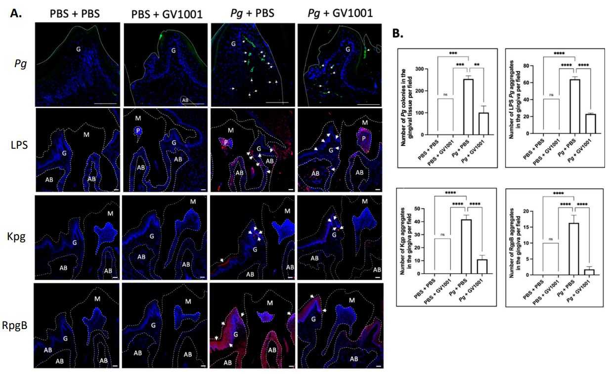 Mouse Anti-P. gingivalis LPS Monoclonal antibody, Clone 3-4B22 (CABT ...
