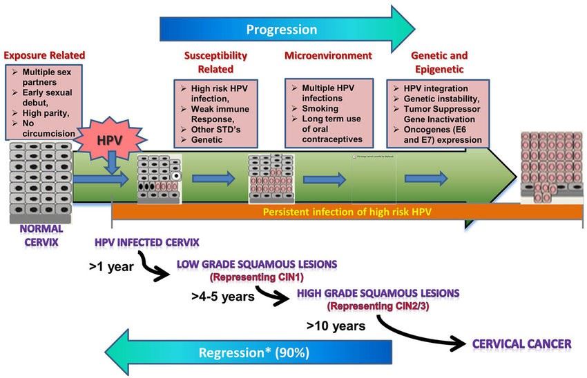 Cancers Caused by HPV - Creative Diagnostics