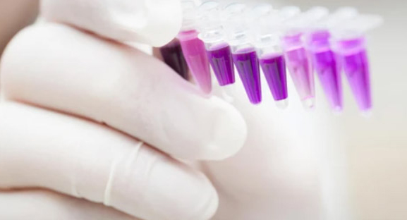 Control Antibodies - Creative Diagnostics