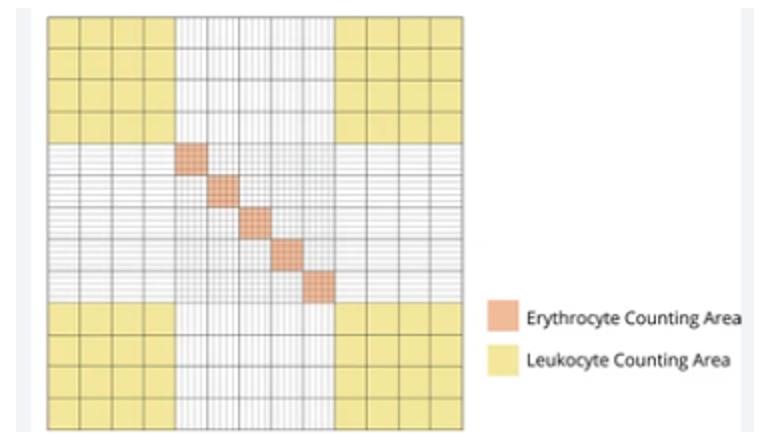 Counting Cells Using a Hemocytometer - Creative Diagnostics