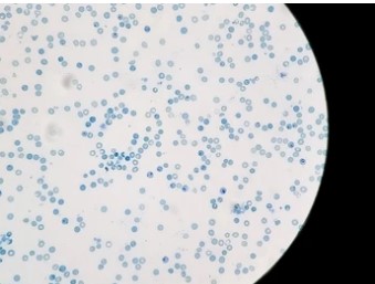 Counting Cells Using a Hemocytometer - Creative Diagnostics