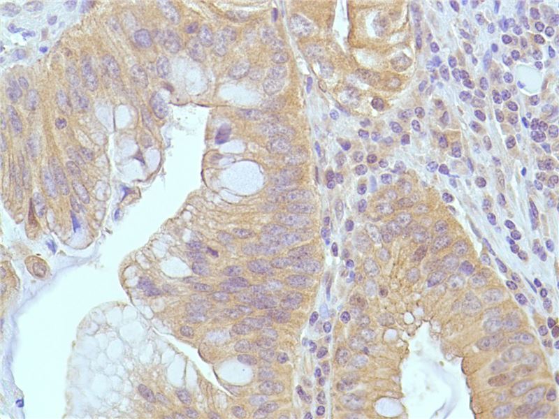 Cysteine Protease - Creative Diagnostics