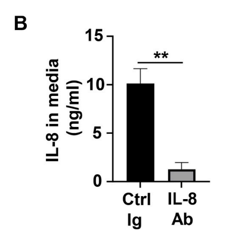 Mouse Interleukin 8 (IL-8/cxcl15) ELISA Kit (DEIA1355) - Creative ...