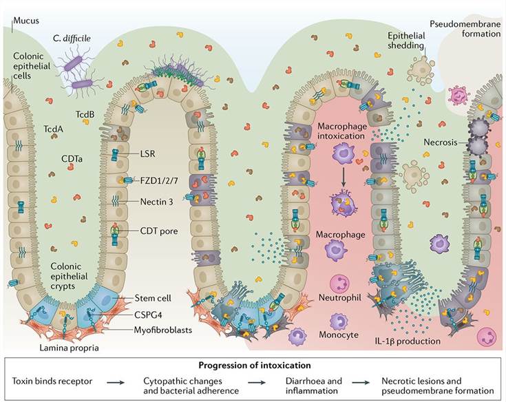 Development of Clostridioides difficile Vaccine - Creative Diagnostics