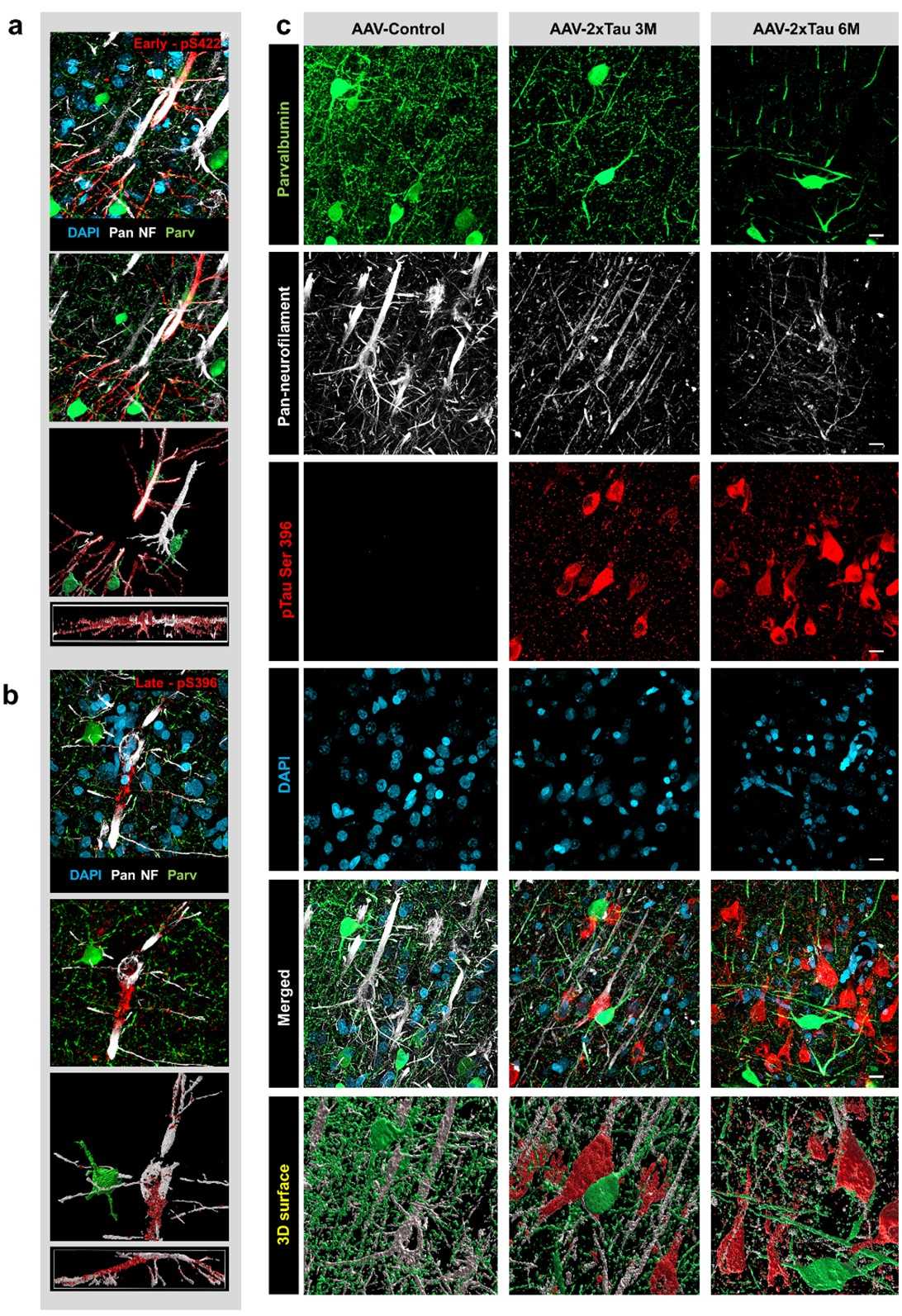 Anti-Pan-Neuronal Neurofilament Marker monoclonal antibody, clone TNJ ...