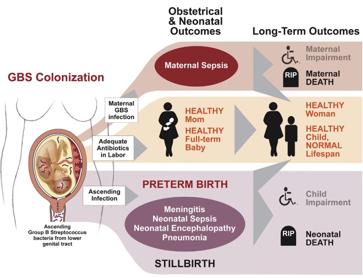 Group B Streptococcus: Pathogenic Mechanisms and Antimicrobial ...