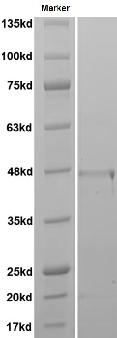 Hepatitis B Virus Surface Antigen L-protein - Creative Diagnostics