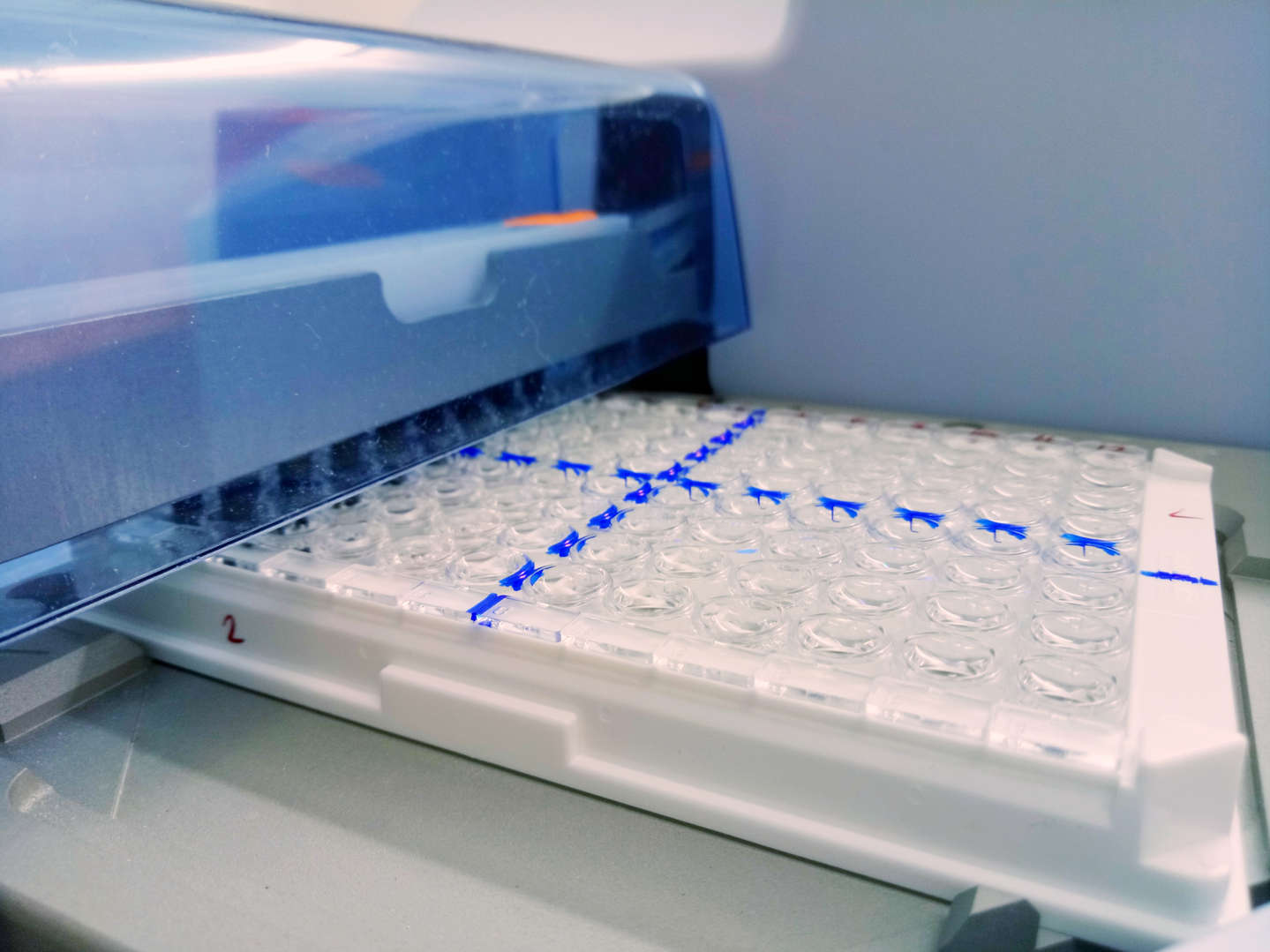 How Creatinine Anti-Immune Testing Redefines Kidney Diagnosis ...