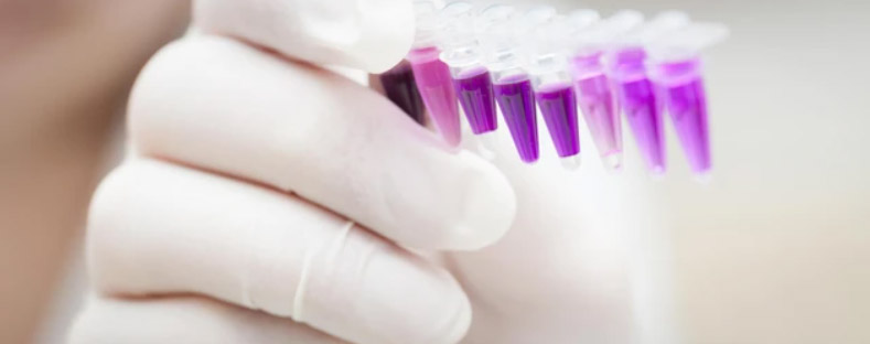 How to Choose An Isotype Control Antibody - Creative Diagnostics