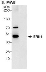 How to Choose and Use Antibodies - Creative Diagnostics