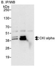 How to Choose and Use Antibodies - Creative Diagnostics