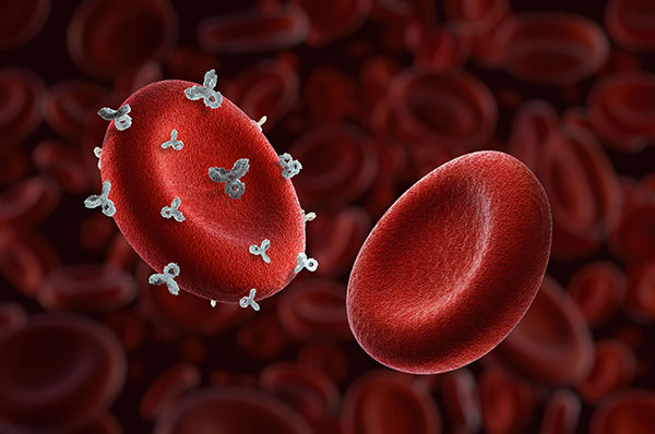 How to Choose and Use Antibodies - Creative Diagnostics