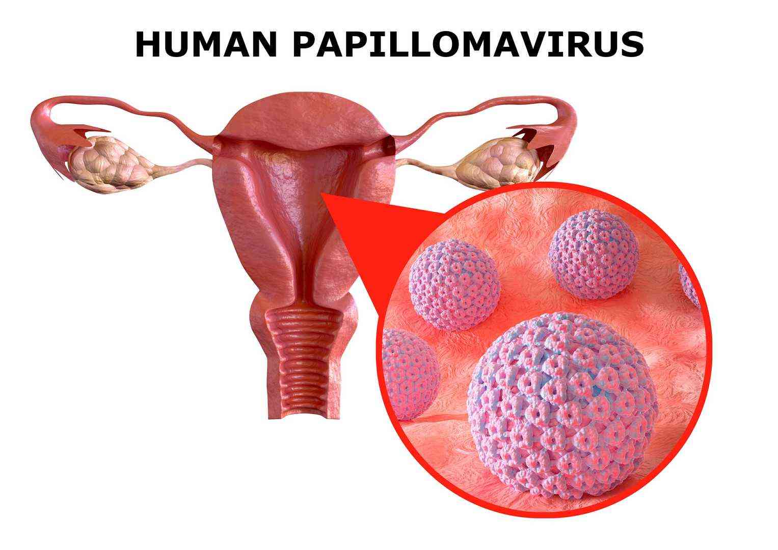 Human Papillomavirus - Creative Diagnostics