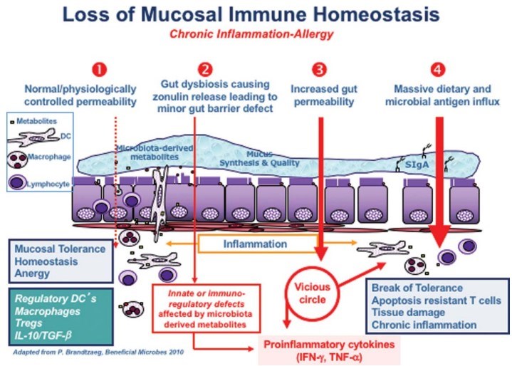 Human Zonulin and TJ - Creative Diagnostics