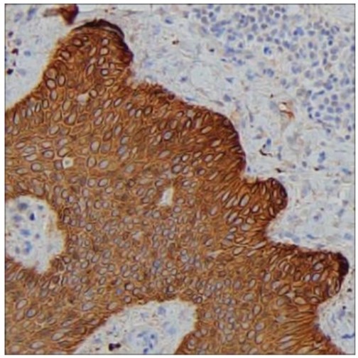 Hybridoma Development Service - Creative Diagnostics