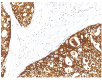 IHC/Pathology Antibodies - Creative Diagnostics
