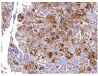 IHC/Pathology Antibodies - Creative Diagnostics