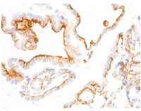 IHC/Pathology Antibodies - Creative Diagnostics