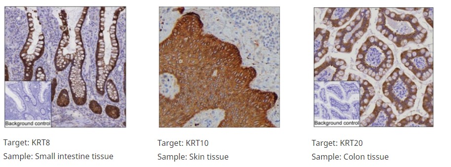 IHC-Positive Hybridoma Screening - Creative Diagnostics