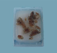 Creative Diagnostics can offer monoclonal or polyclonal antibodies for IHC with different ...