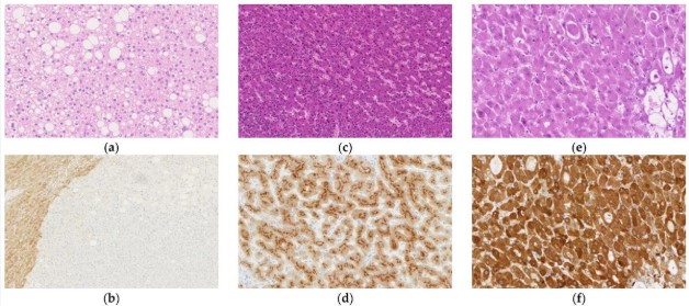 Creative Diagnostics can offer monoclonal or polyclonal antibodies for IHC with different ...