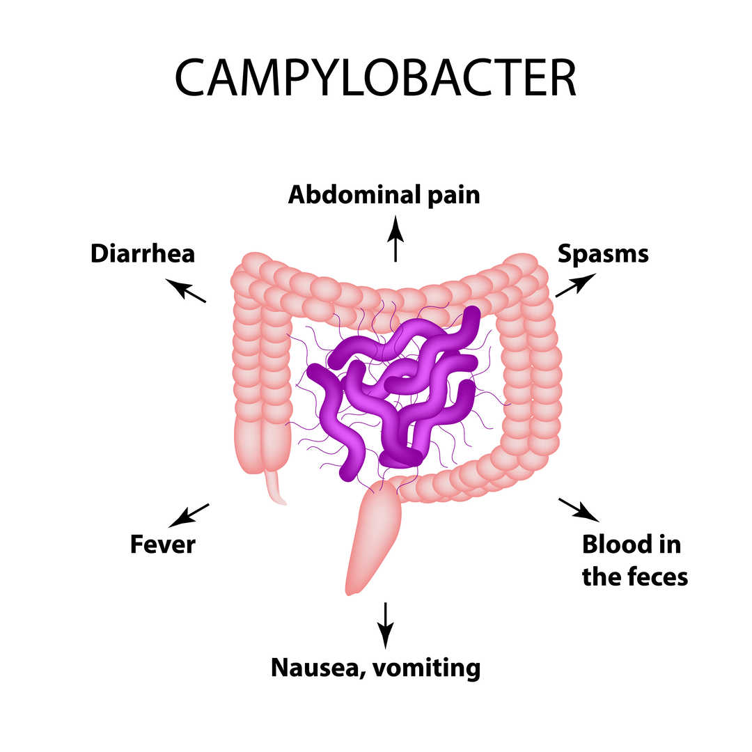 Important Campylobacter bacteria - Creative Diagnostics