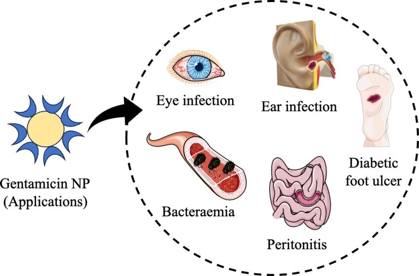 Introduction to Gentamicin - Creative Diagnostics