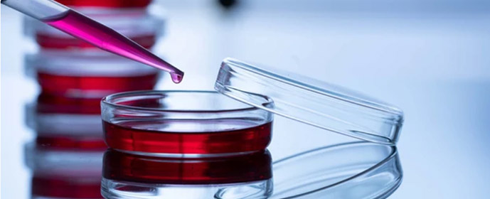 Knockout Cell Lines - Creative Diagnostics